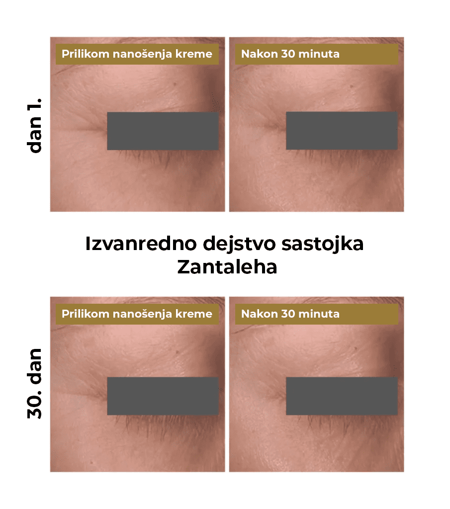 Lepota Kože | Triple Action Rejuvenation | Podmlađivanje